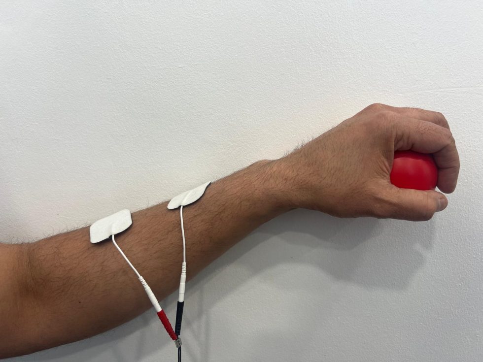 Functional Electrical Stimulation (FES) | HM Rehab Basics