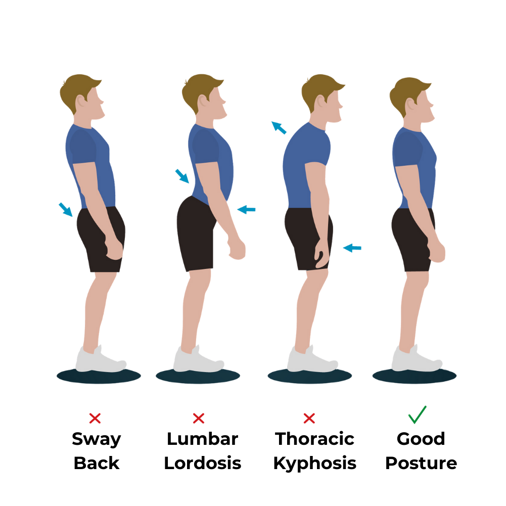 Postural Syndrome/Pain | HM Rehab Basics